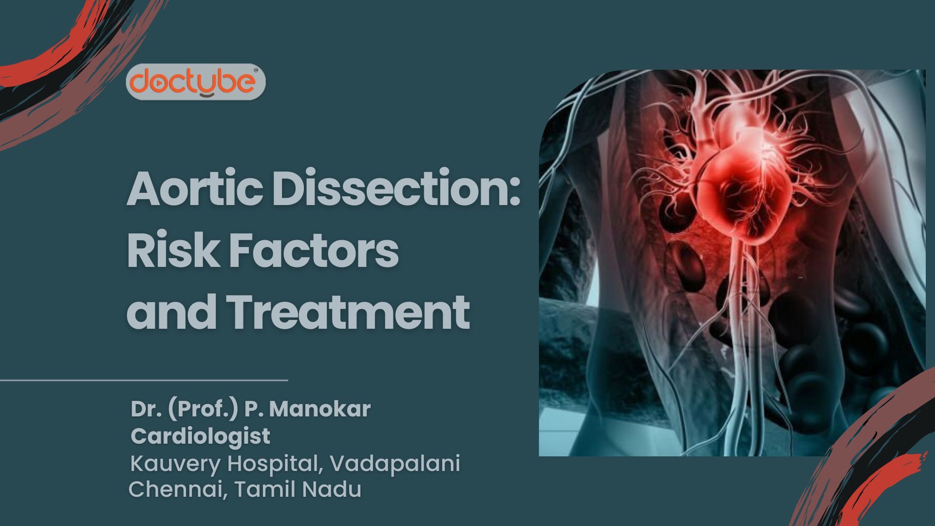 Aortic Dissection: Risk Factors and Treatment