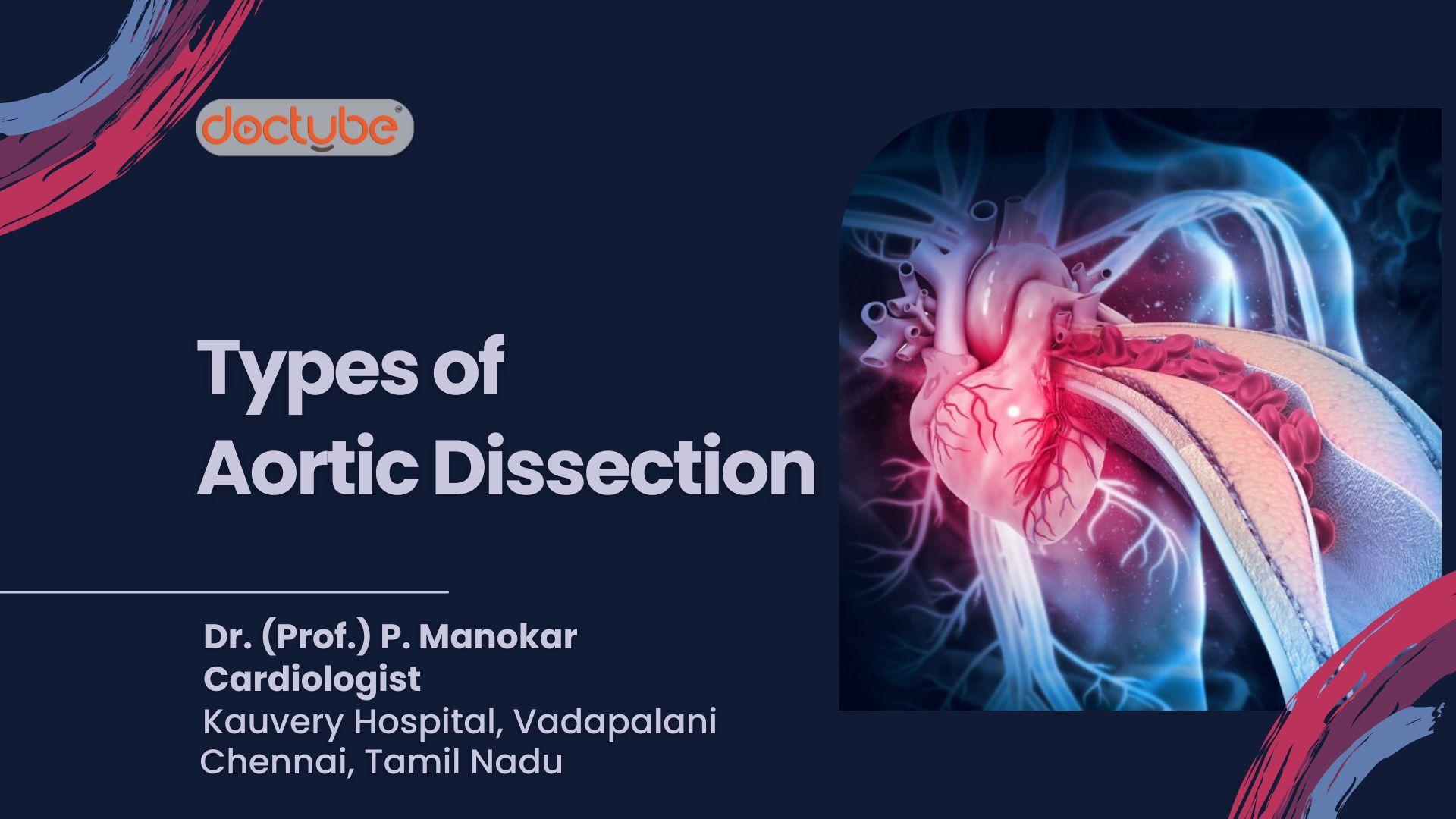 Types of Aortic Dissection