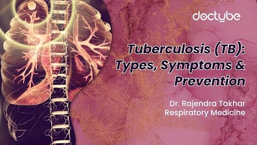 Tuberculosis (TB): Types, Symptoms & Prevention