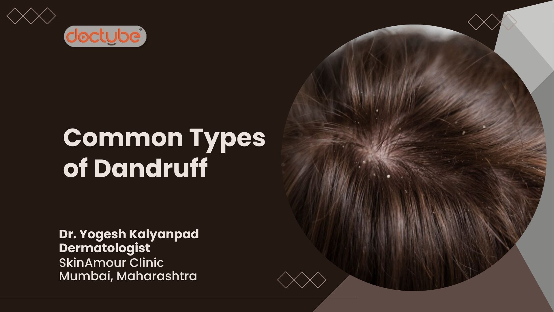 Common Types of Dandruff