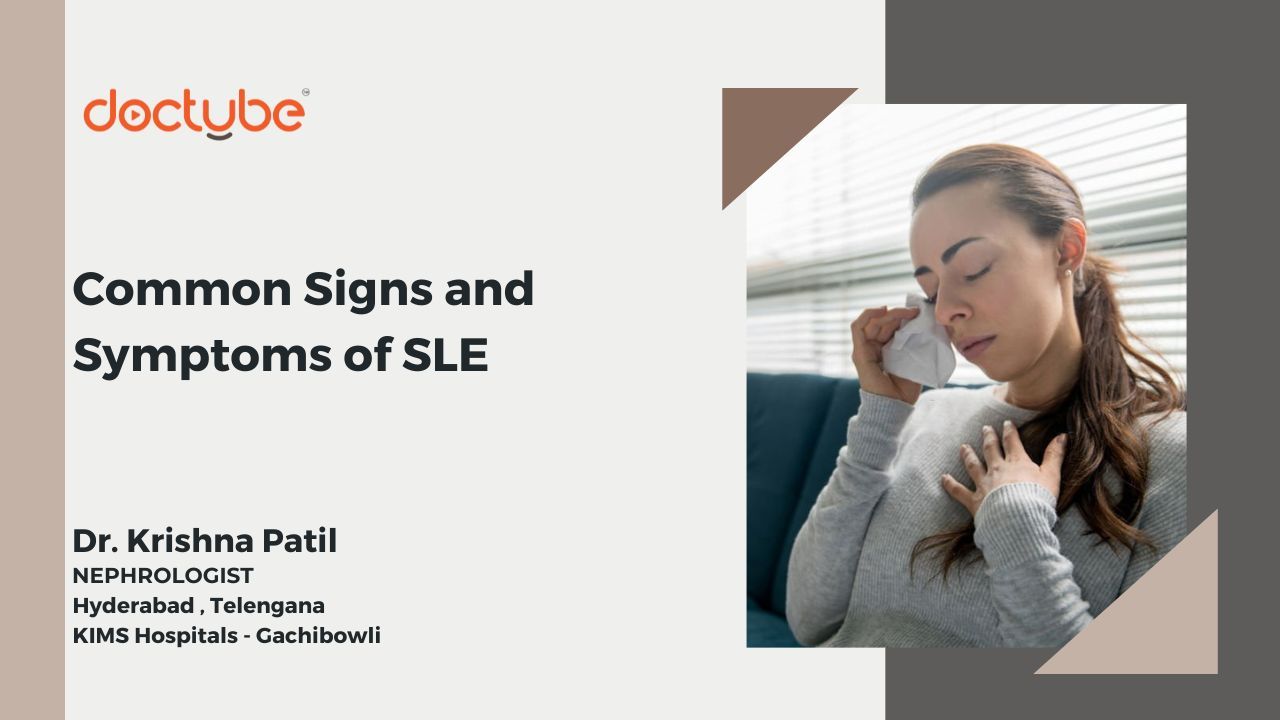 Common Signs and Symptoms of Lupus (SLE)
