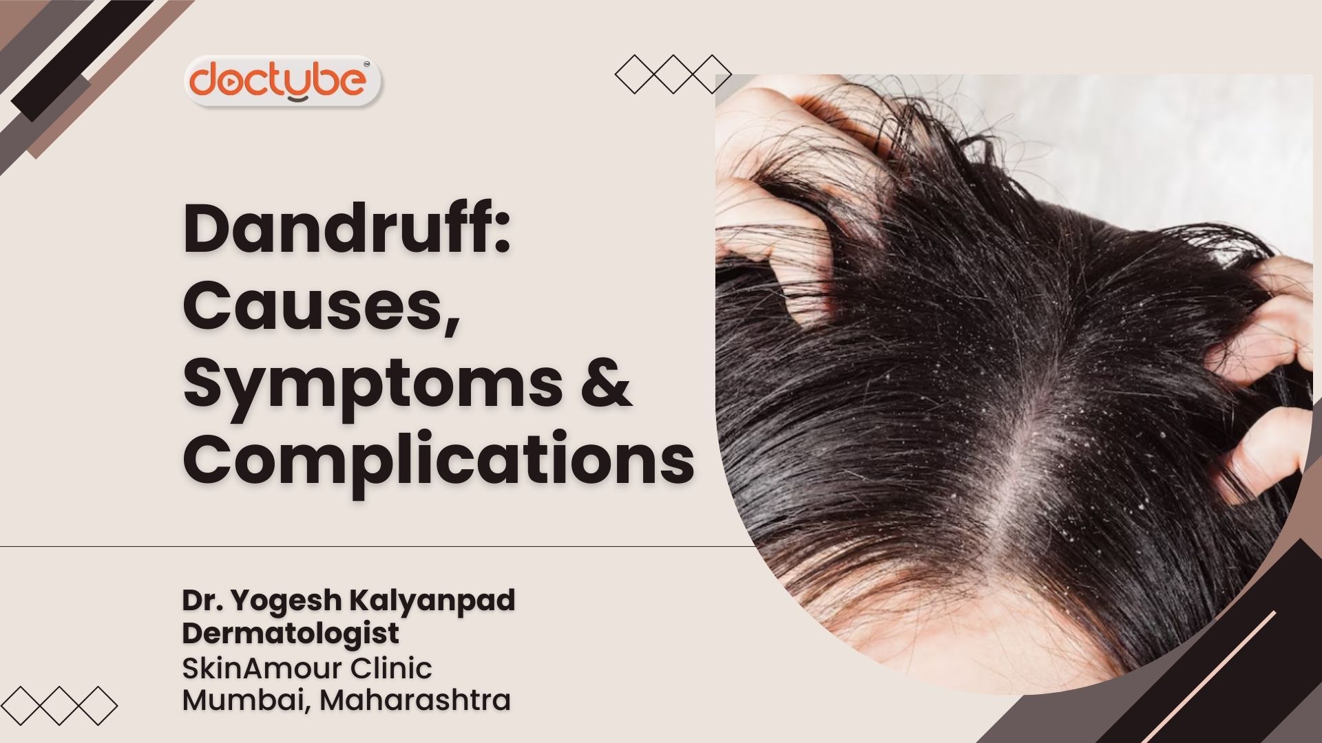 Dandruff: Causes, Symptoms & Complications