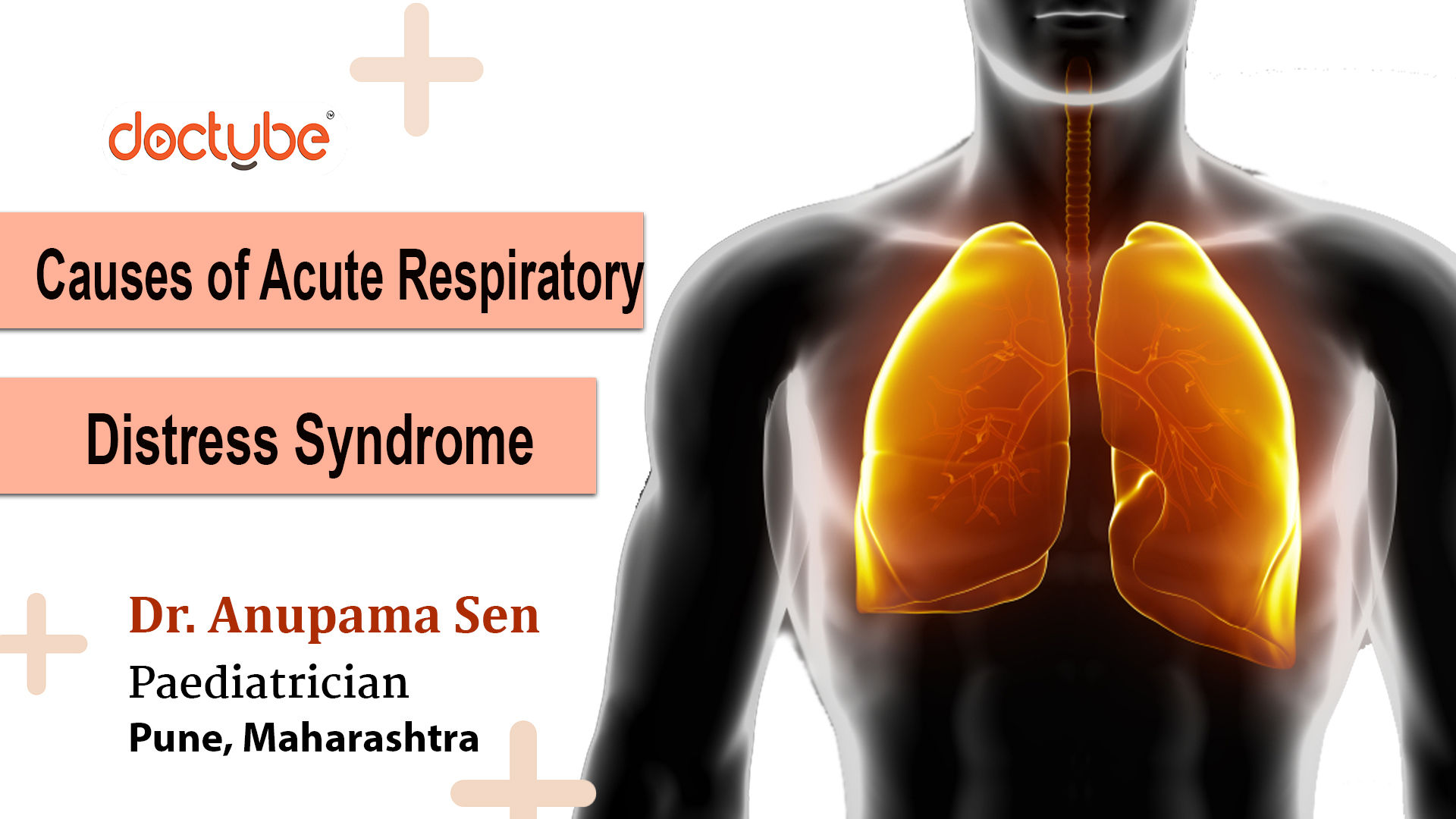 Causes of Acute Respiratory Distress Syndrome